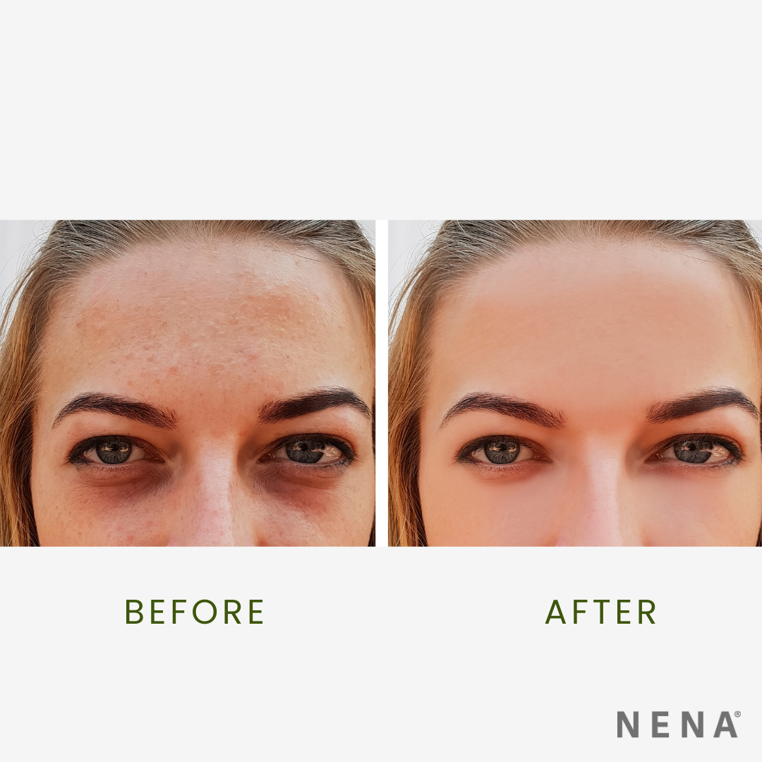 Best Face Mask for Dry Skin - Nena Glacial Oceanic Clay Mask